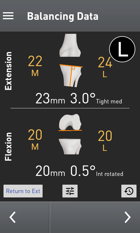 Case Study: Use of Portable, Precision Alignment - OrthAlign
