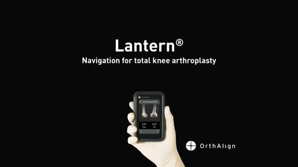 OrthAlign | Lantern Knee Overview