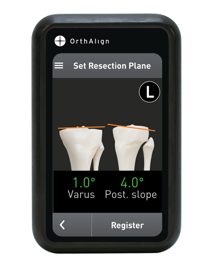 Knee Pain - OrthAlign