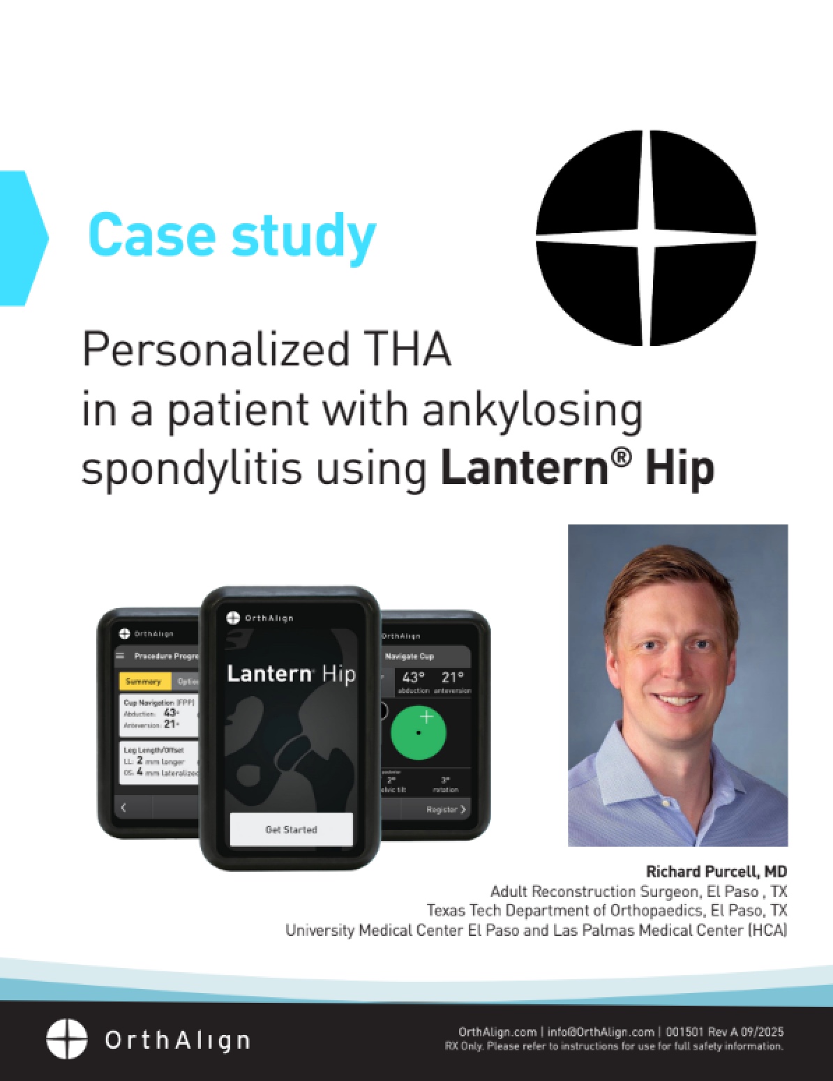 OrthAlign | Lantern Hip Overview